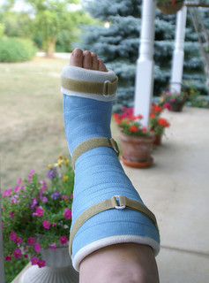 Contentment and A Broken Ankle | by Katherine Kehler